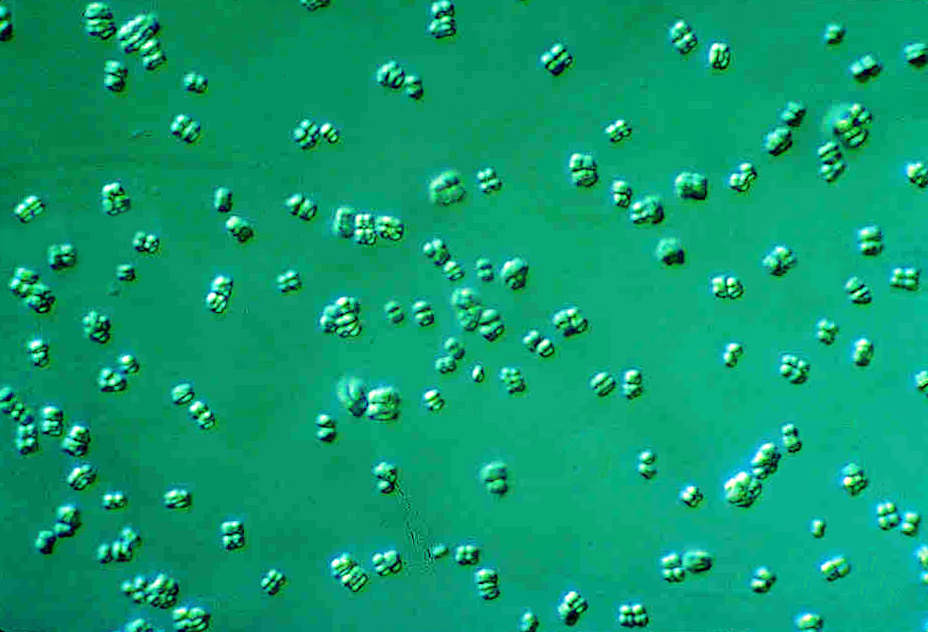 Ward's® Live Kocuria rhizophila (Micrococcus luteus) Culture | Bacteria ...