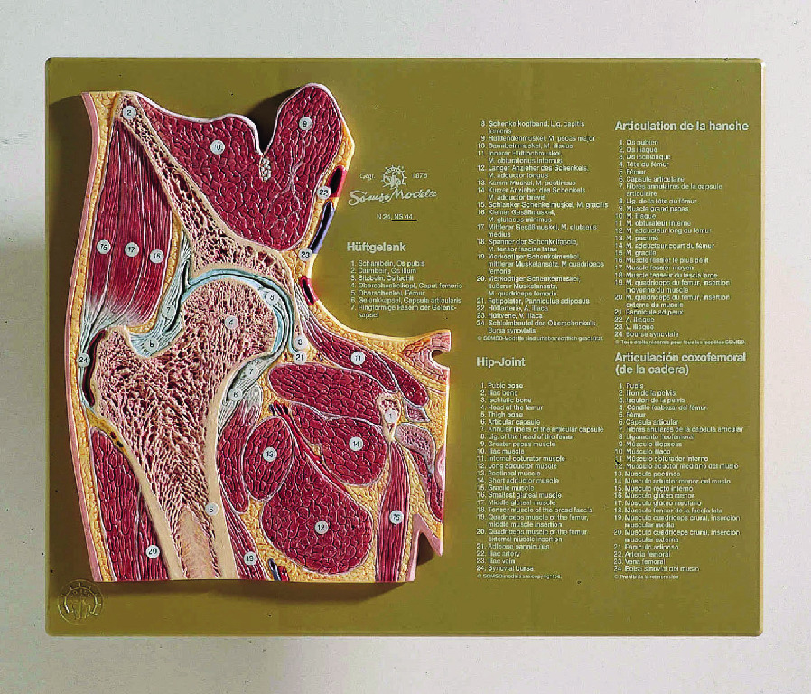 Somso® Hip Joint Cross Section Model | Human Biology Models