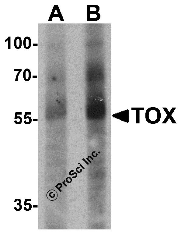 Anti-TOX Rabbit Polyclonal Antibody | Antibodies