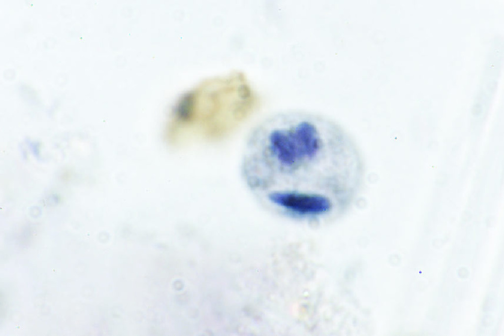 Entamoeba histolytica, Cysts Slide | Prepared Slides