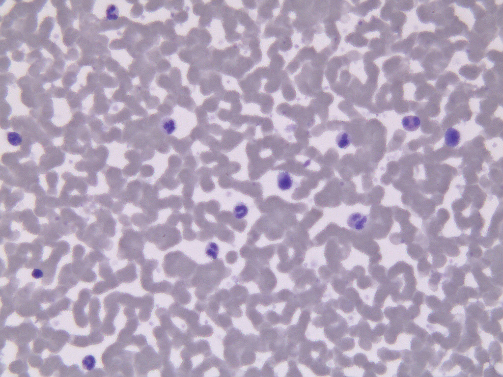 Polycythemia Slide | Prepared Slides