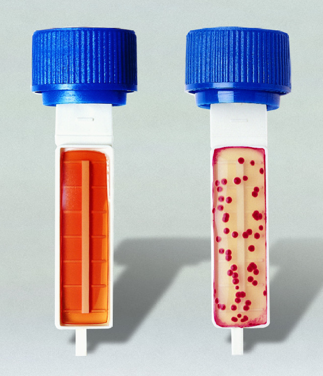 undefined | Microorganism Tests