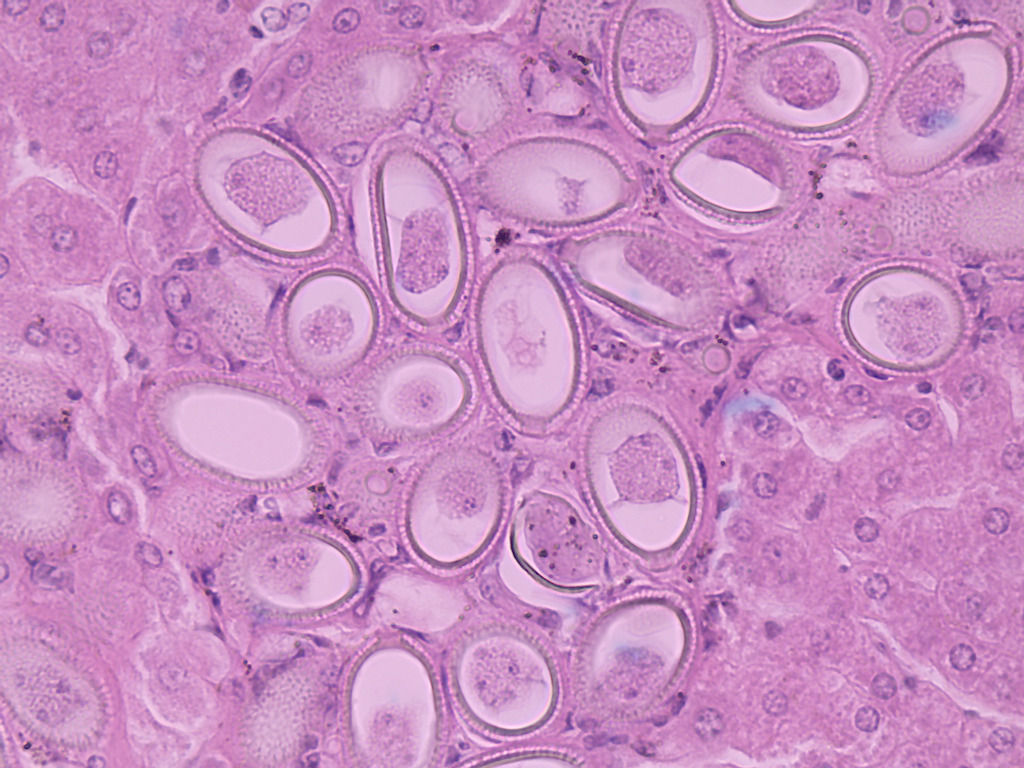 Capillaria hepatica Slide | Prepared Slides