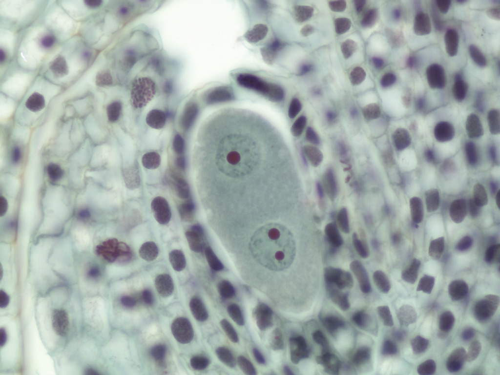 Lilium Ovary, Binucleate Embryo Sac Slide | Prepared Slides