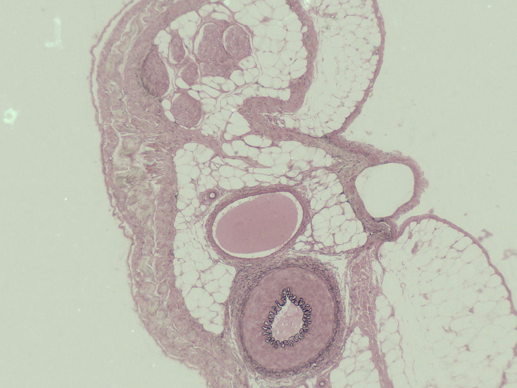 Artery Vein And Nerve Slide Prepared Slides