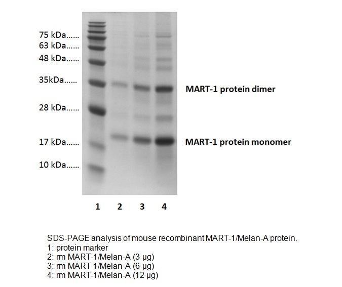 Mouse Recombinant MART1 (from E. coli) | Proteins and Peptides