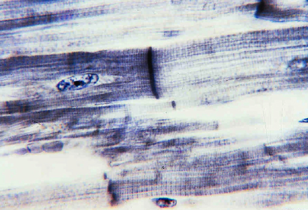 Cardiac Muscle, Intercalated Discs Slide | Prepared Slides