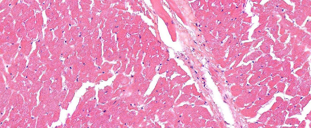 Cardiac Muscle, Mammal Slide | Prepared Slides