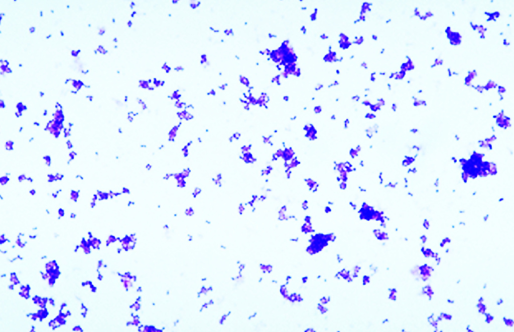 Ward's® Live Corynebacterium xerosis Culture | Bacteria - Living Material